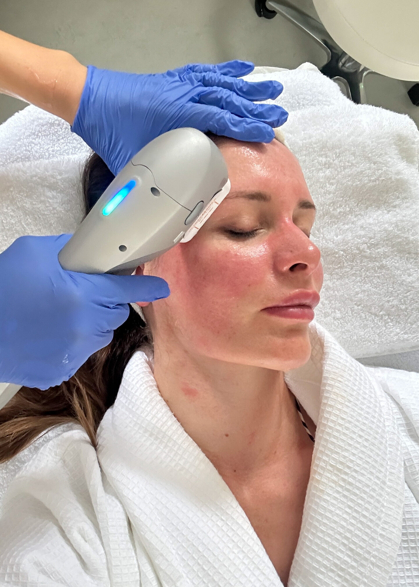 All you need to know about Ultralift treatment - Chic Journal